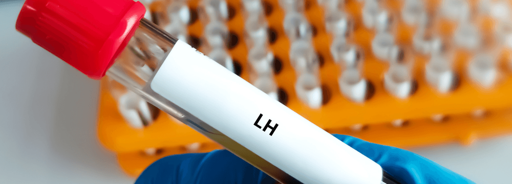 Hormon luteinizujący (LH) - normy, badania, interpretacja wyników ...
