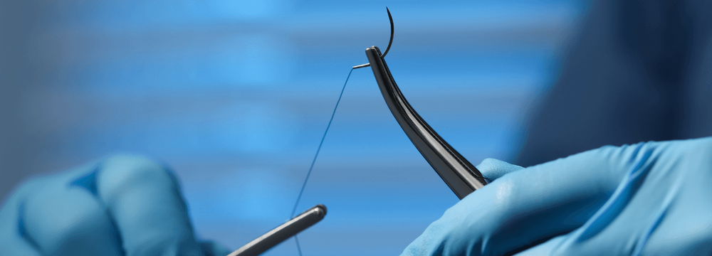 Zbyt wcześnie czy za późno? Kiedy zdejmować szwy i co grozi, jeśli tego ...