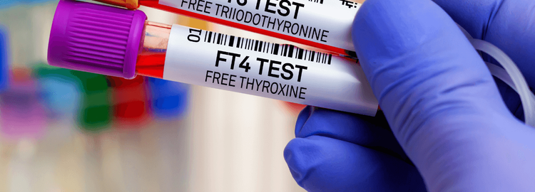 FT4 - normy, badania i interpretacja wyników | Home Lab